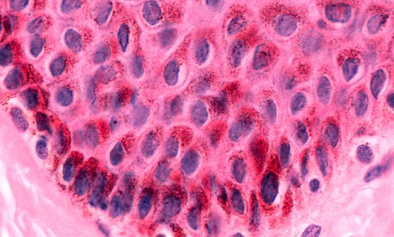 SALUD Y MEDICINA: Probablemente estas Infectado por el VPH y no ...