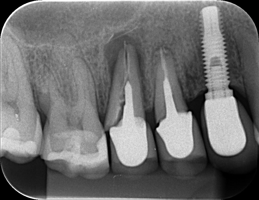 "Te vejo por dentro": Julho 2014
