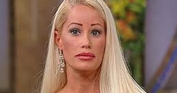 Barbie Plastic Surgery Before and After Photos - Before and After ...