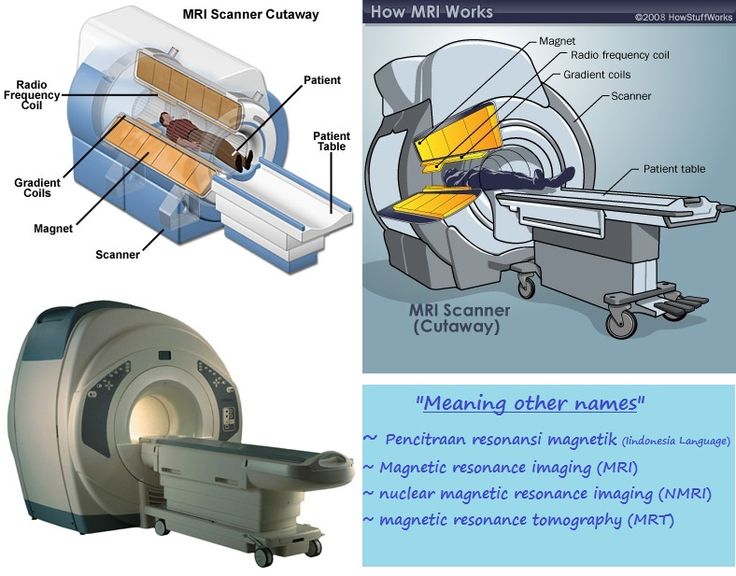 MRI: My Radiology Insight: Second Week!