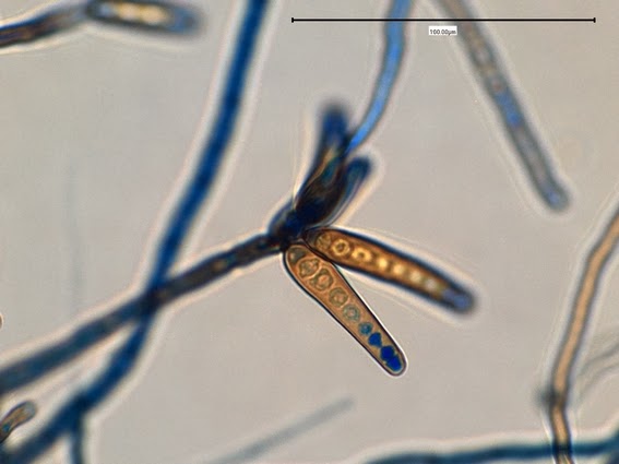 Fun With Microbiology (What's Buggin' You?): Exserohilum rostratum