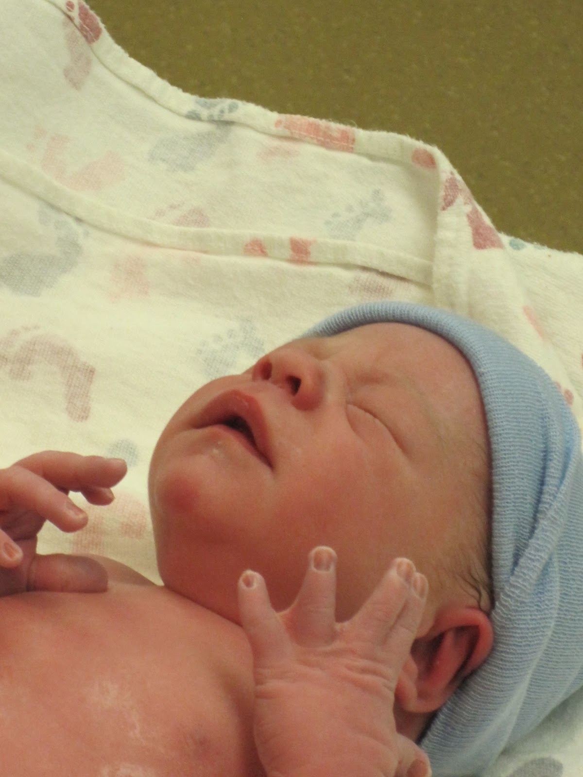 A story of syndactyly: I. How we found out.