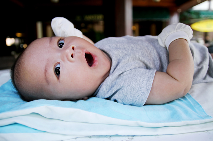 Tips Jaga Anak: Demam Kuning Penyakit Utama Bagi Bayi Baru Lahir