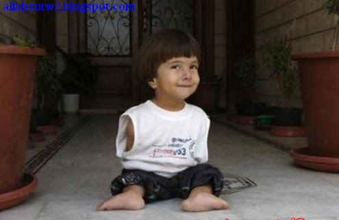 All About World & Wrestling: Kid without Hand and short legs