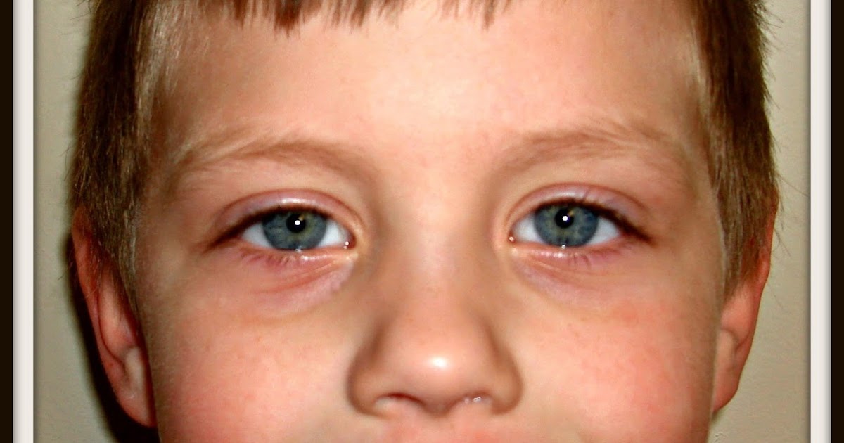 Wordless Wednesday - Wiggly Tooth