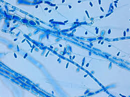 Ringworm (Dermatophytosis) pada Sapi - Mydokterhewan