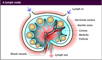 A Spot to Jot - Mantle Cell Lymphoma
