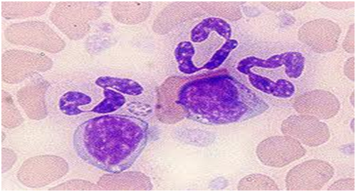 MICROBIOOLOGIA Y PARACITOLOGIA : RICKETTSIAS Y EHRLICHIAS
