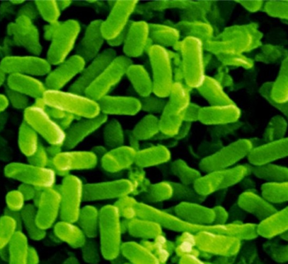 Diário de Biologia: Arquea ou Bactéria?