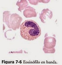 Hematologia: Serie Leucocitaria, Eosinófilos