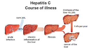 Tareas para un 20: TRIPTICO HEPATITIS C