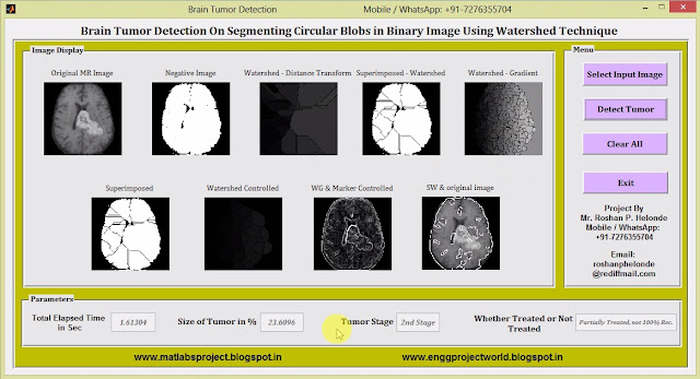 Brain Tumor Detection Using Watershed Technique Matlab Project with Source Code ~ ENGINEERING ...