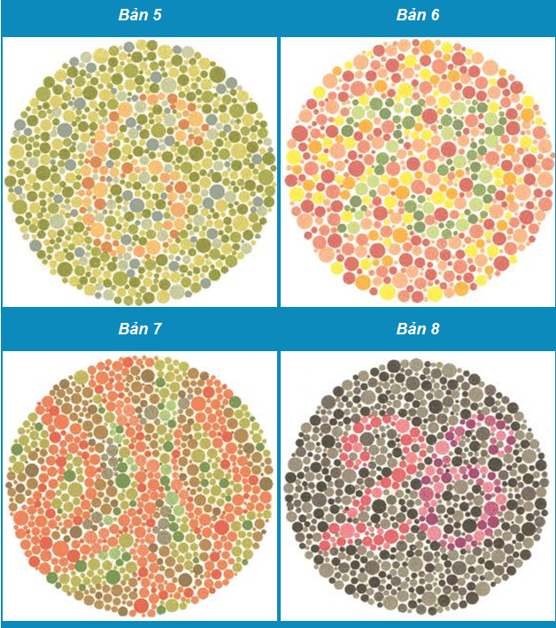 Trung Tâm Mắt Hải Yến: Kiểm tra về bệnh mù màu