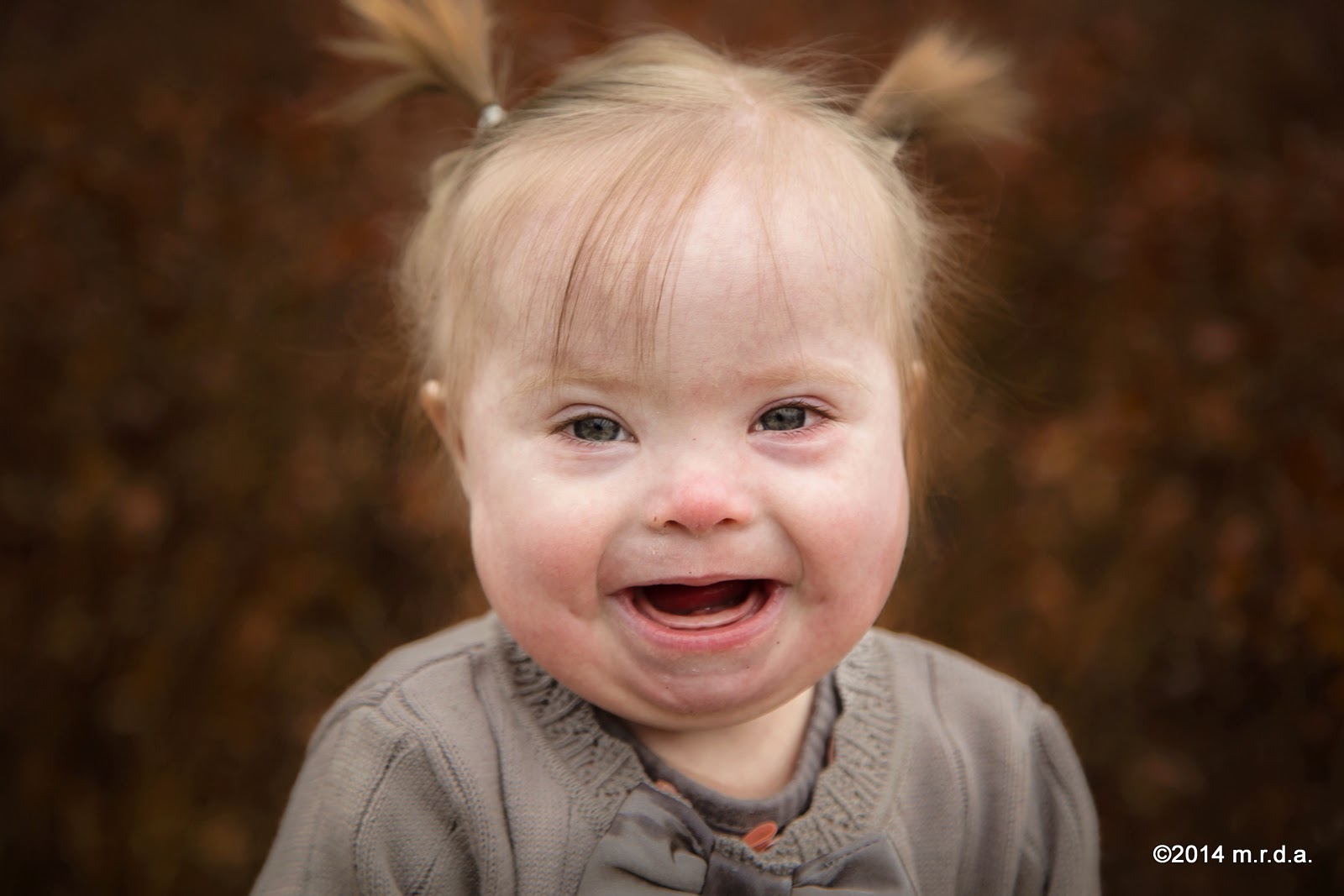 The Hailey Herald: Faces of Down Syndrome