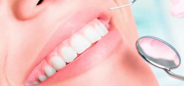 Control de Placa Supragingival: INDICE DE Ö LEARY