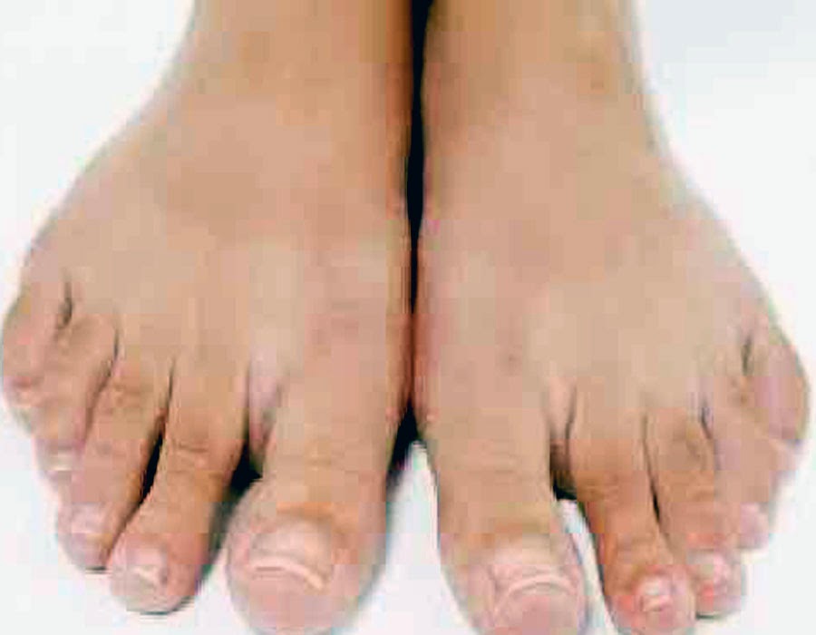 The Best Massaging 9 Unexpected Benefits Of Foot Massage That Make You