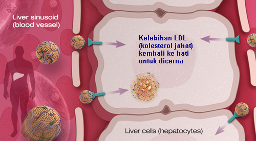 Statin, Obat Kolesterol Tinggi, Cara Kerja dan Efek Sampingnya