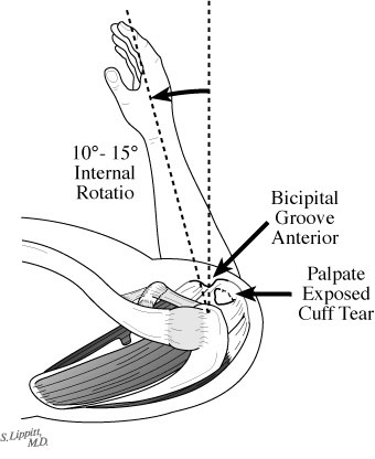 UW Shoulder and Elbow Academy: Rotator Cuff 6 - Clinical examination ...