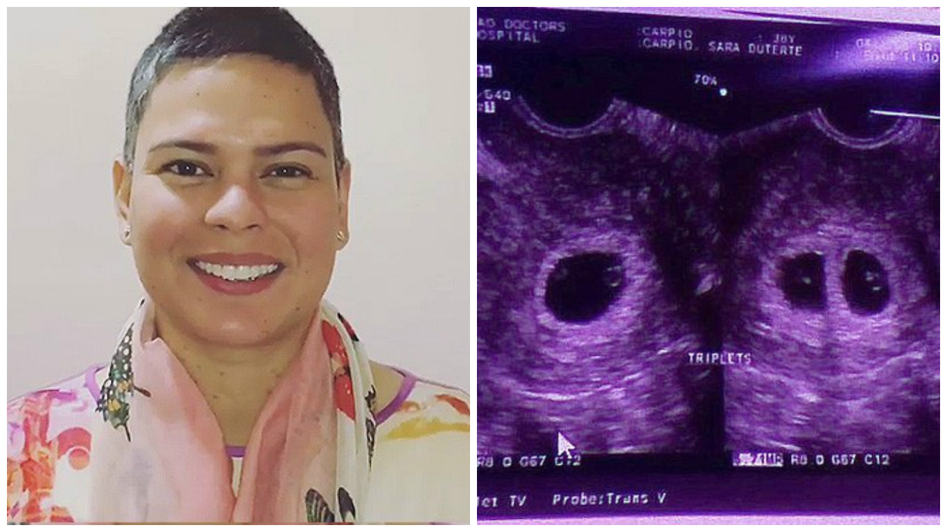 Presidential daughter Inday Sara Duterte is expecting triplets