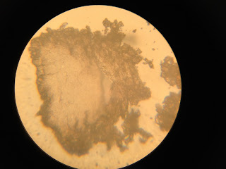 Hershie's Blog: Wart Virus (Under a Microscope)