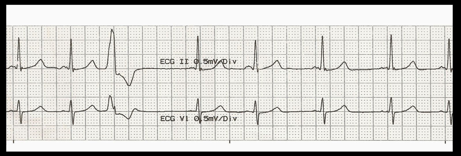 Practice Rhythm Strips 276