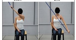 Techniques for stroke rehabilitation: PNF patterns