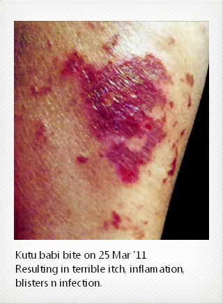 Life's Indulgences: Be wary of the kutu babi