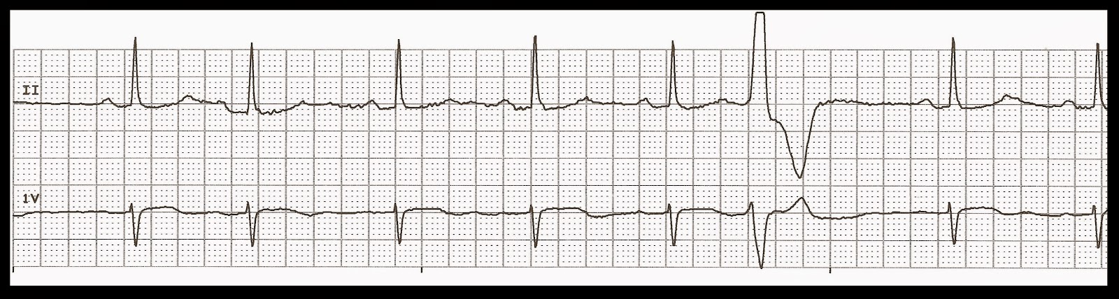 EKG Rhythm Quiz 288