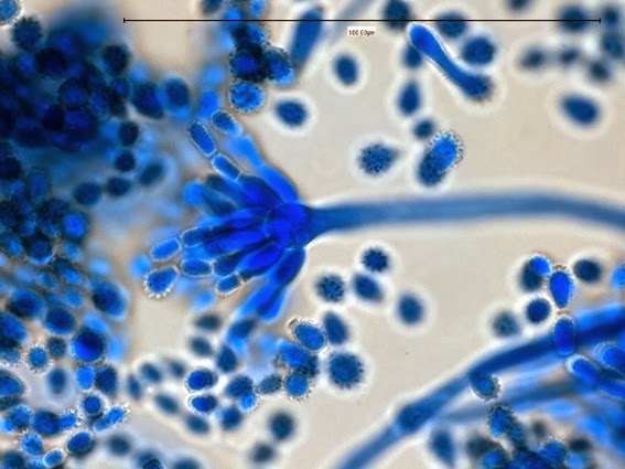 Fun With Microbiology (What's Buggin' You?): Eurotium herbariorum ...
