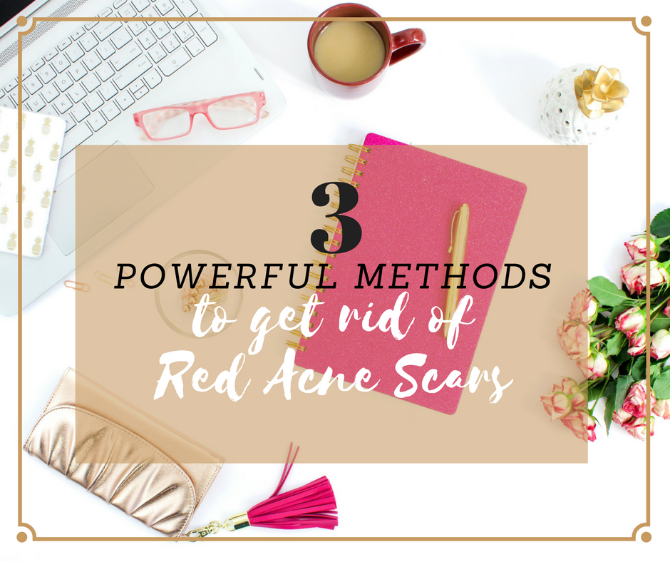 How to Get Rid of Red Acne Scars - 3 Powerful Methods - Beauty Bedazzled
