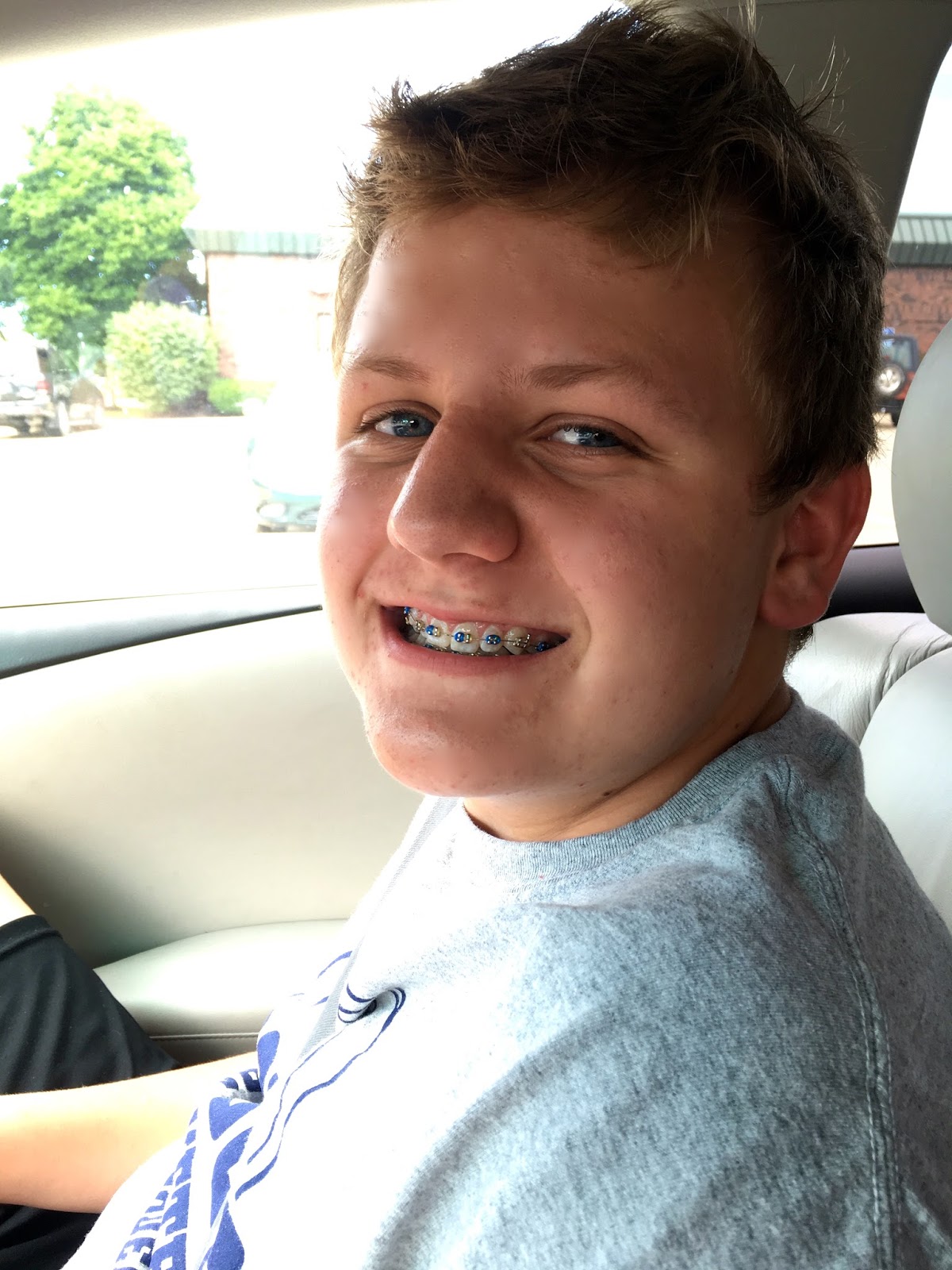 A Medley of Memories: Metal Smile