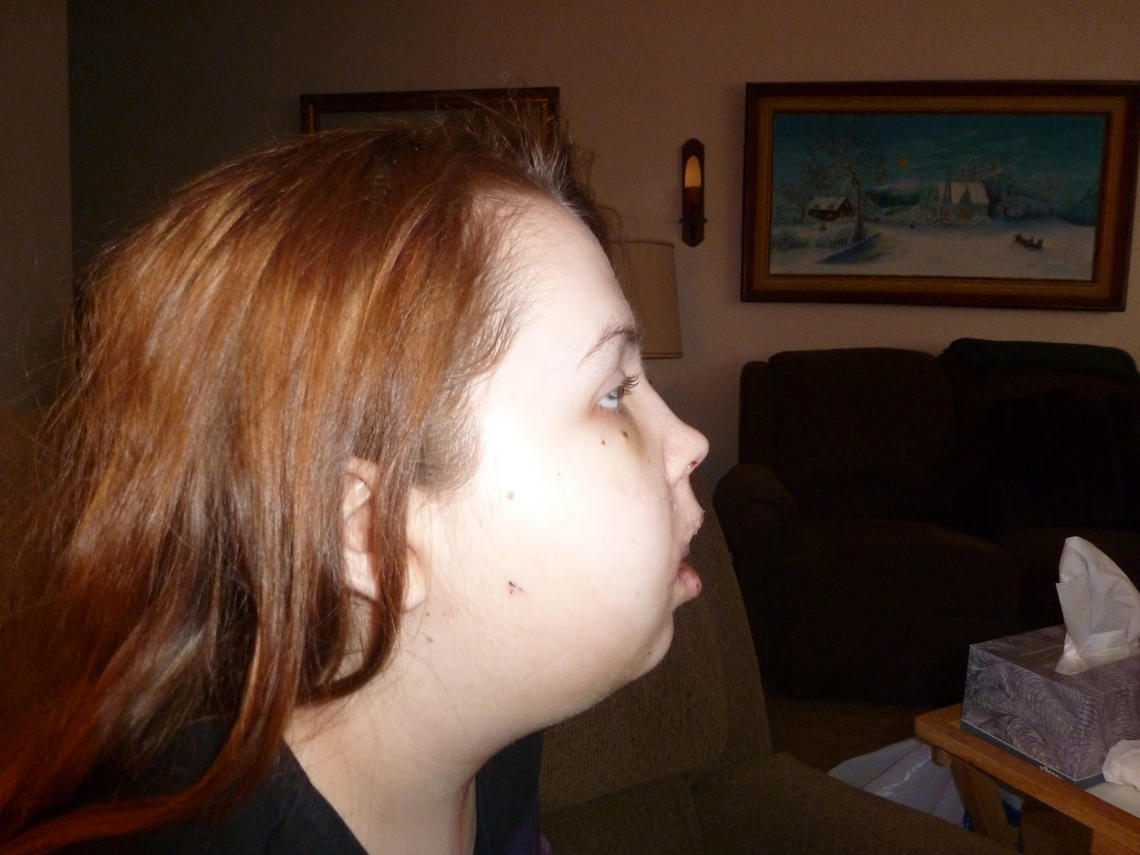 Jaws of Steel - A Double Jaw Surgery Transformation