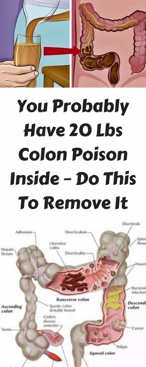 These 2 Homemade Colon Cleanse Recipes Help Eliminate All Deposited ...