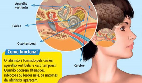 Nem toda tontura é labirintite! | CMS Dr. Eithel Pinheiro