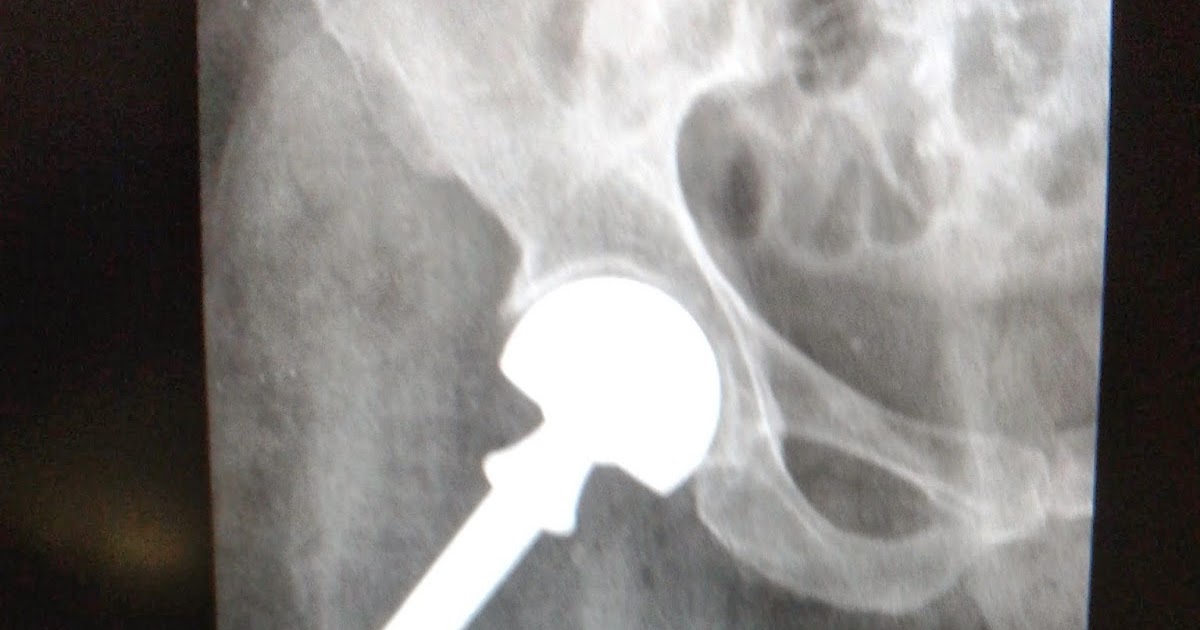 DICAS DE RADIOLOGIA - Tudo Sobre Radiologia: IMAGENS RADIOLÓGICAS