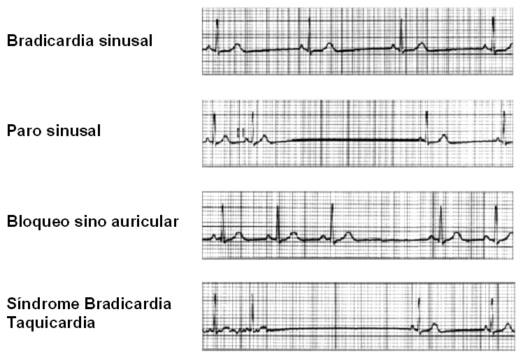 humanis corporis fabrica: CARDIOLOGIA. ELECTROCARDIOGRAMA