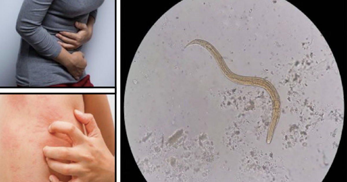 Know The Early Signs That In Human Body Parasites Attacks and How to ...