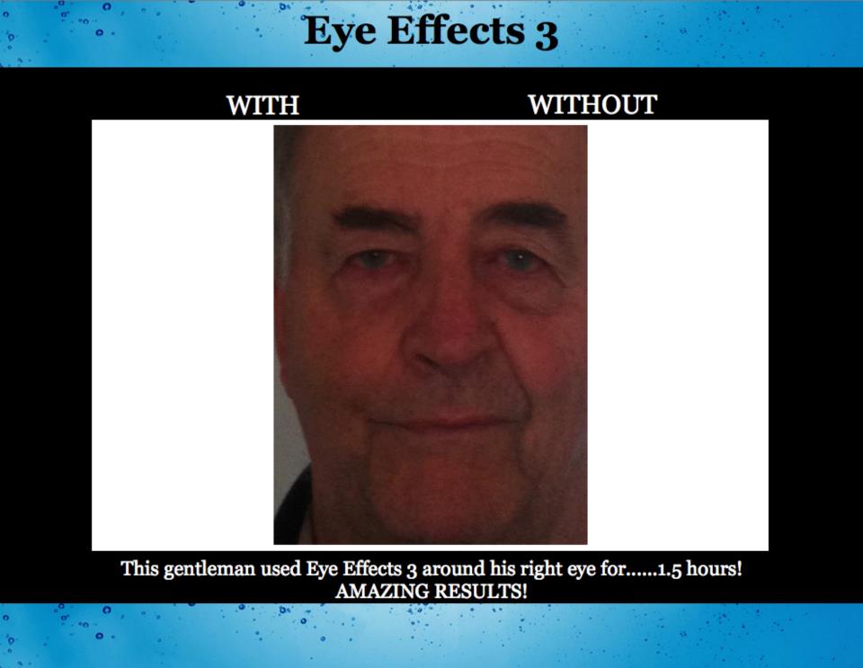 NuCerity: How to reduce the look of fine lines & crow's feet with ...