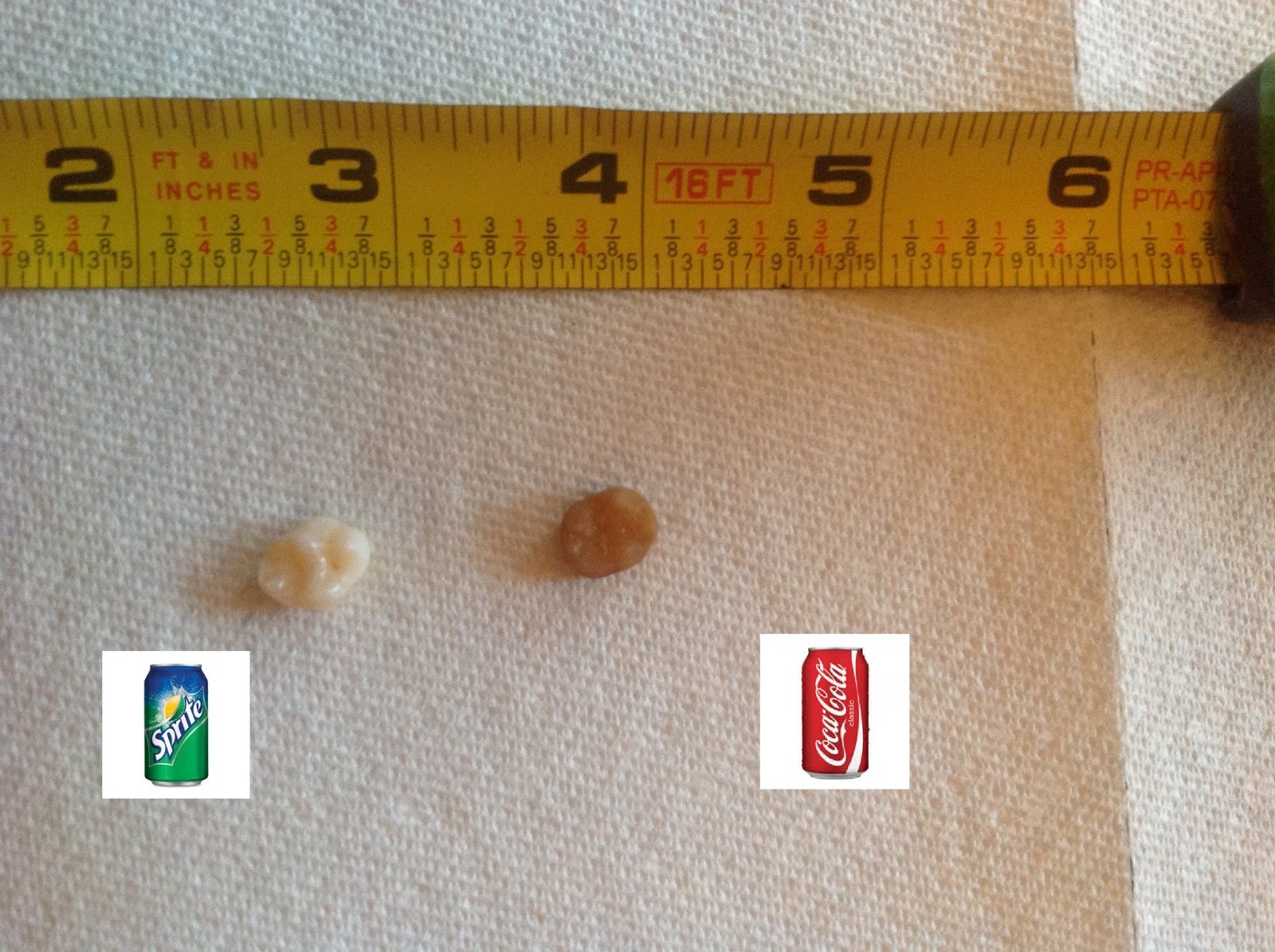 Comparing the Corrosive Effect of Coke and Sprite: This Stuff Will Rot ...