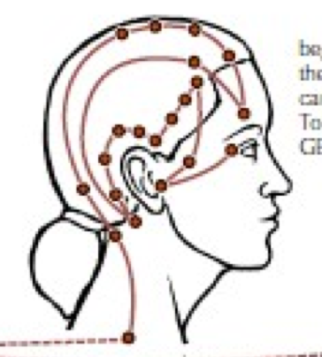 MERIDIAN: Migraines and the Meridian System