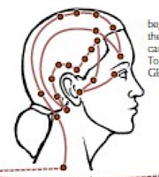 MERIDIAN: Migraines and the Meridian System