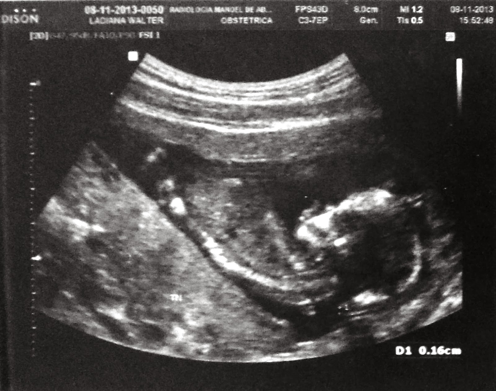 Diário da Barrigudinha: 16 semanas - Fotos bebê