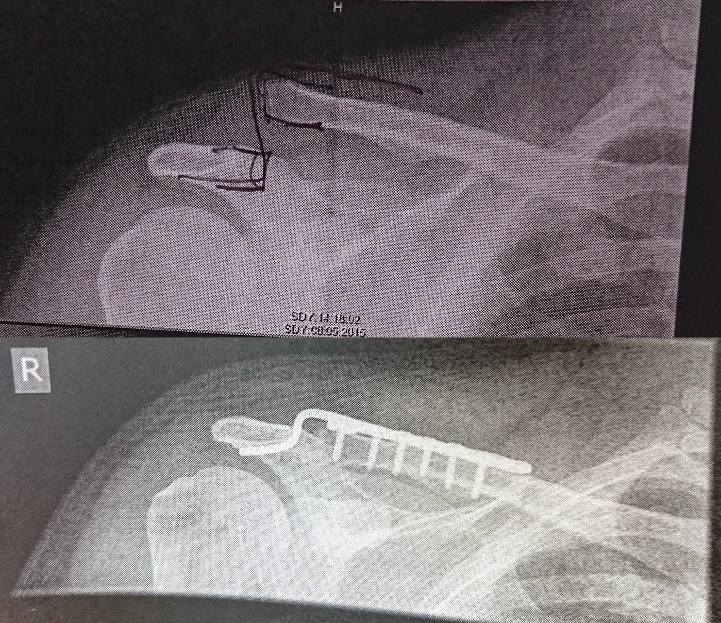 The life and suffering of Haptain Cook: Dorchester