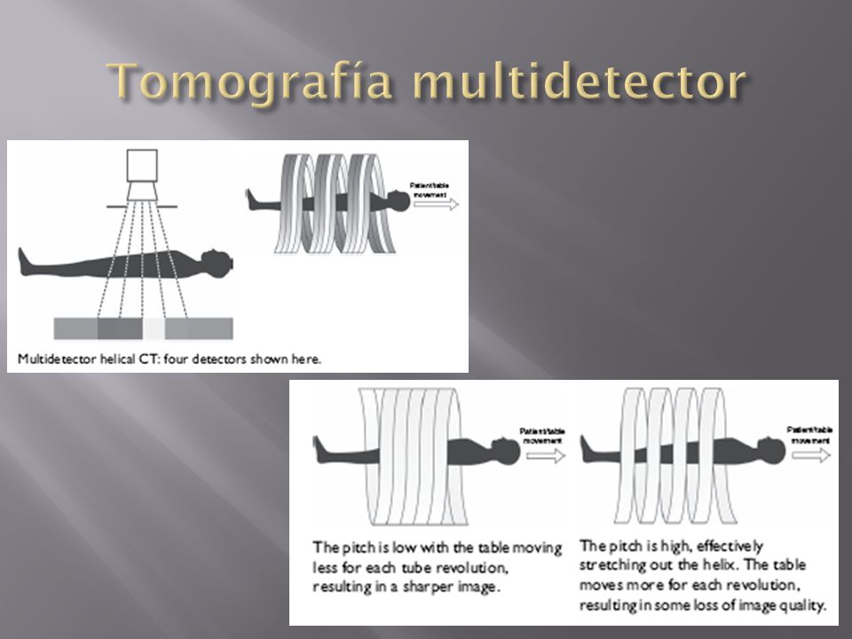 INSTRUMENTACIÓN Y EQUIPOS EN DIAGNOSTICO POR IMÁGENES: TC HELICOIDAL Y TCMD