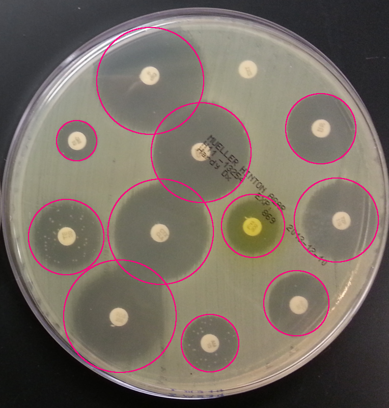 crazybiocomputing: Analysis of an Antibiogram