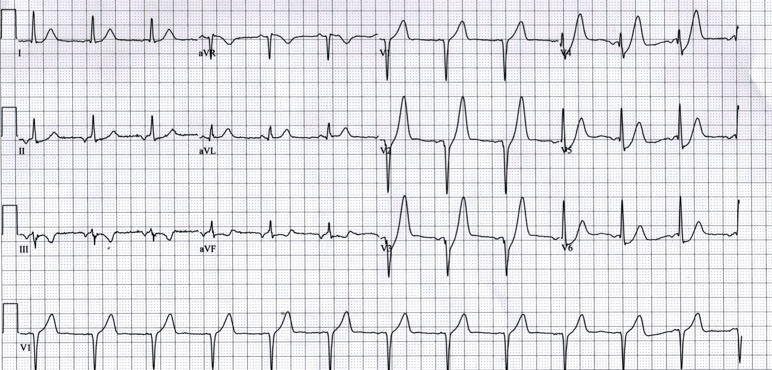 ER goldbook: EKG interpretation