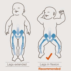 KENAPA KENA BEDUNG BAYI?