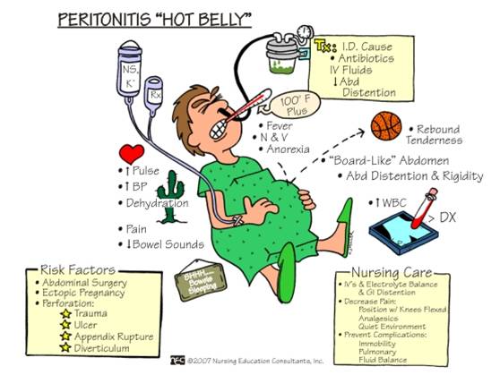 Peritonitis - Hot Belly-ABC Medicine
