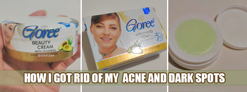 Goree Cream and Soap Review: Can It Effectively Vanish Your Acne and ...