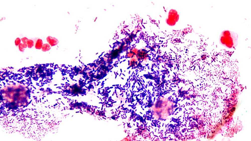 Gardnerella vaginalis